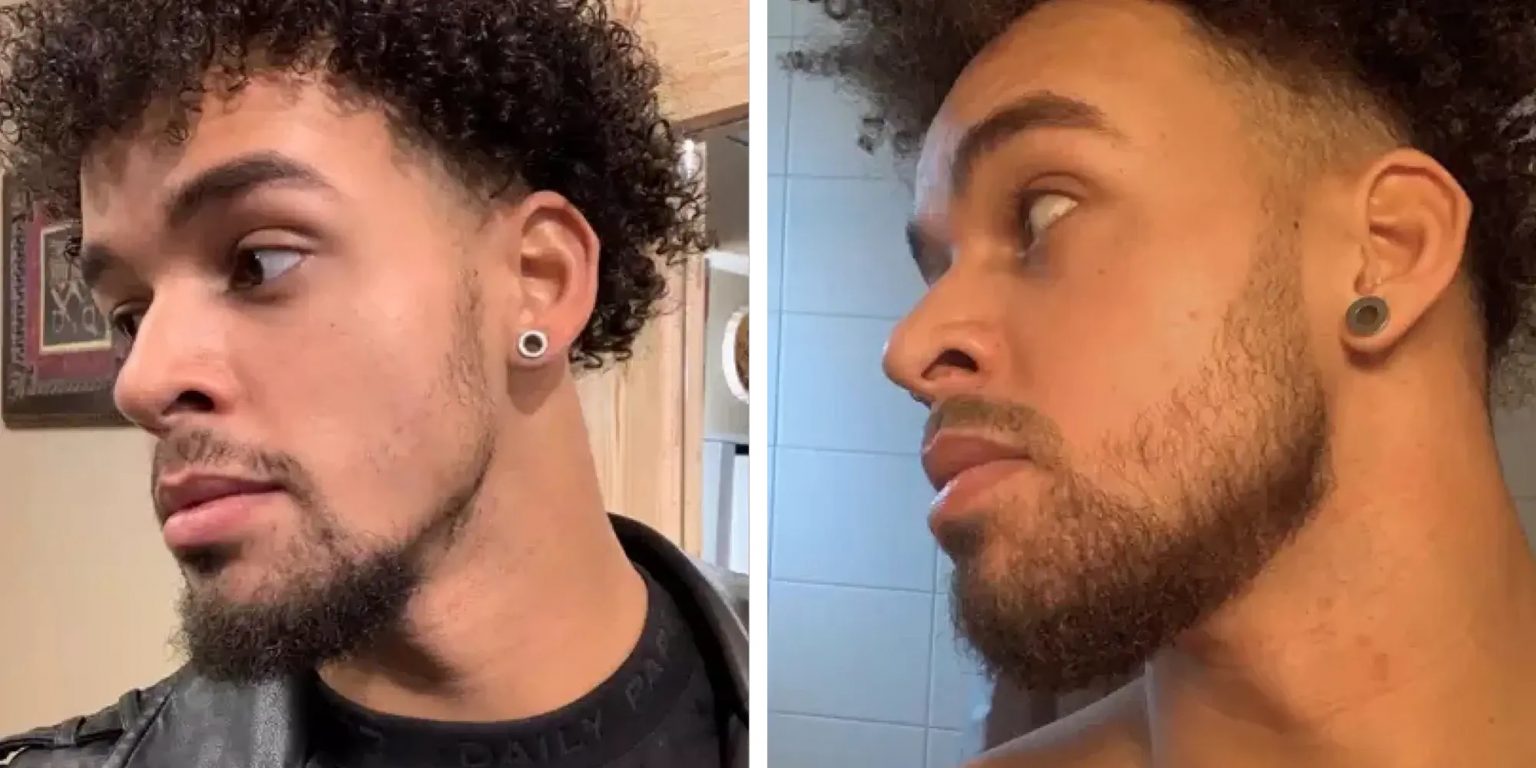 Weinig baardgroei? Dit baardgroei supplement werkt écht