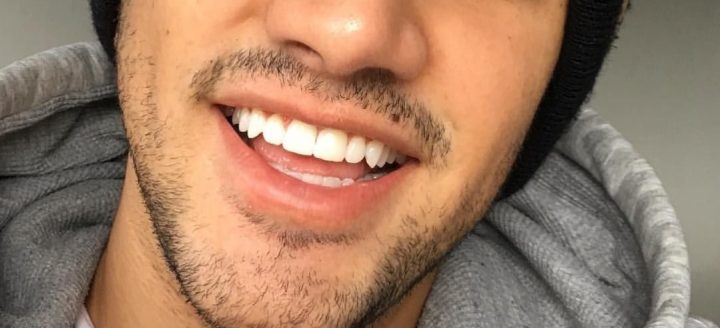 Witte tanden: eet deze 5 voedingsmiddelen voor een stralende lach